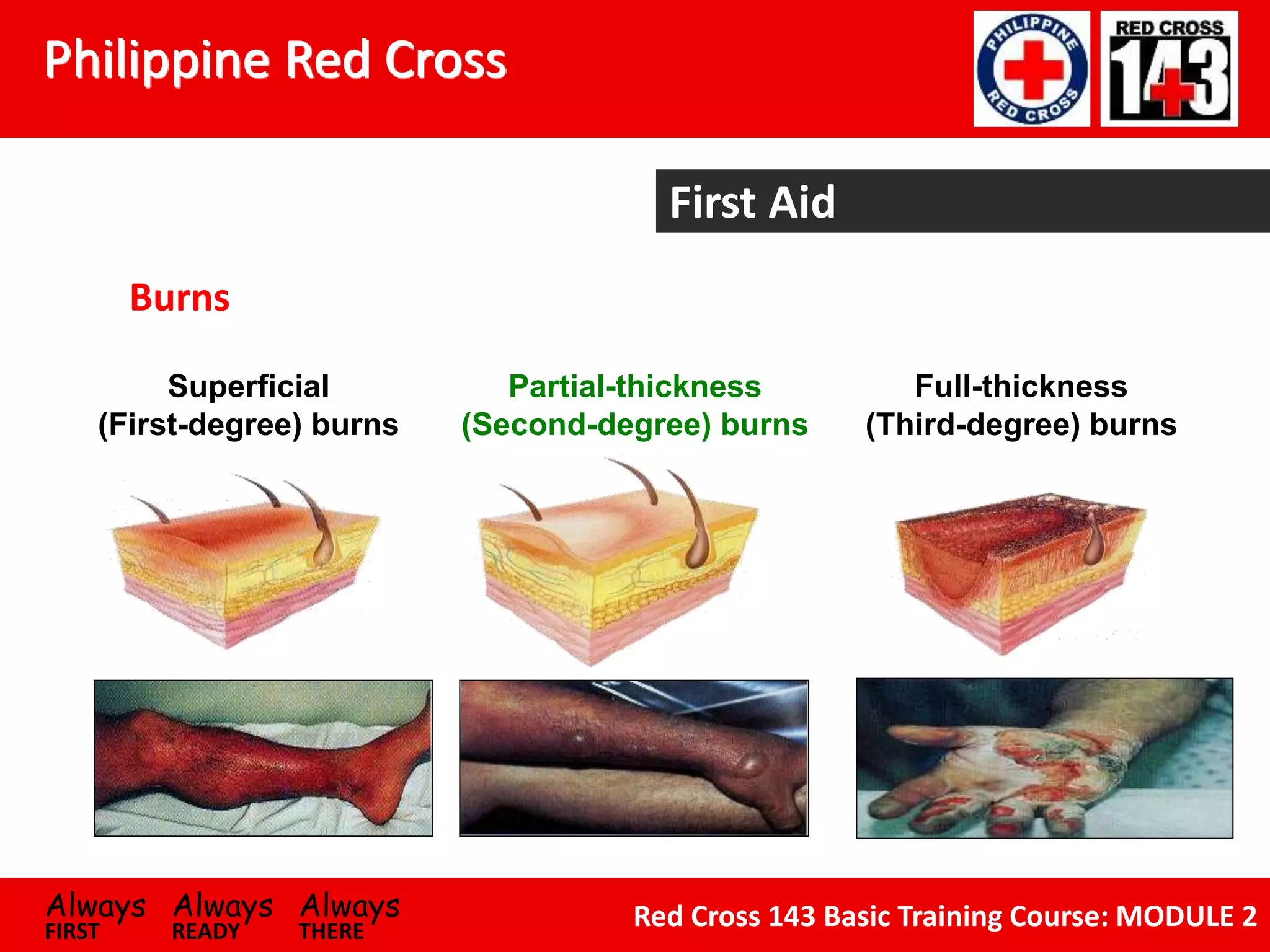 Philippine Red Cross BLS-CPR.ppt