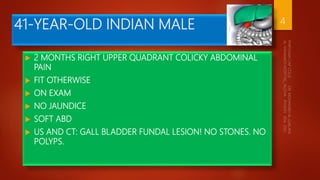 Phrygian Cap Colic | PPTX