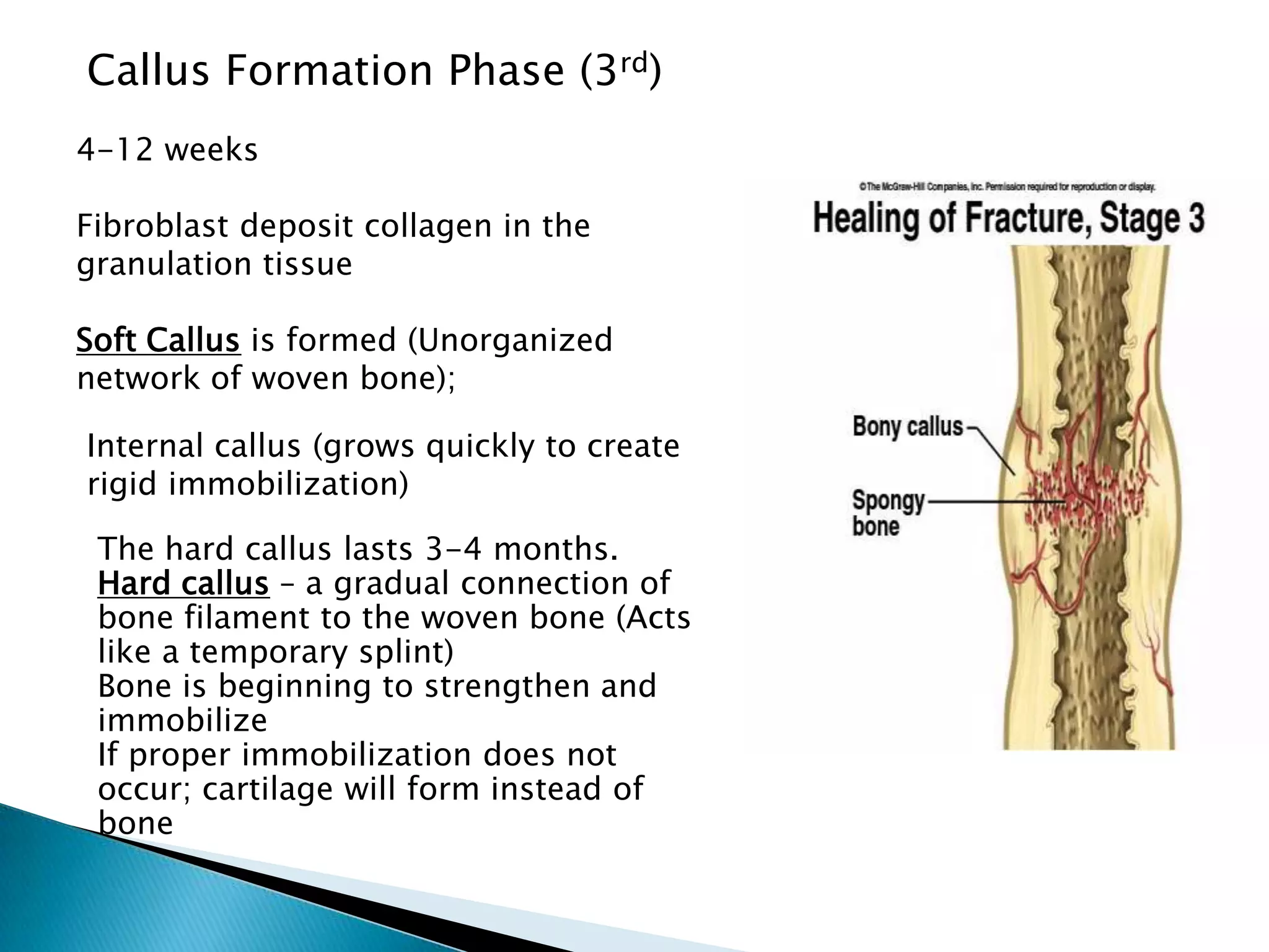 Phsiology of fractures | PPTX