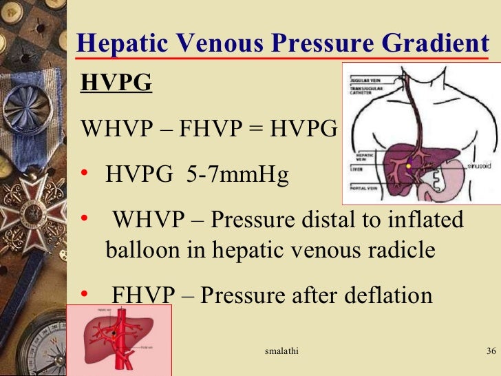 Portal Hypertension in Children.. Dr.Malathi Sathiyasekaran