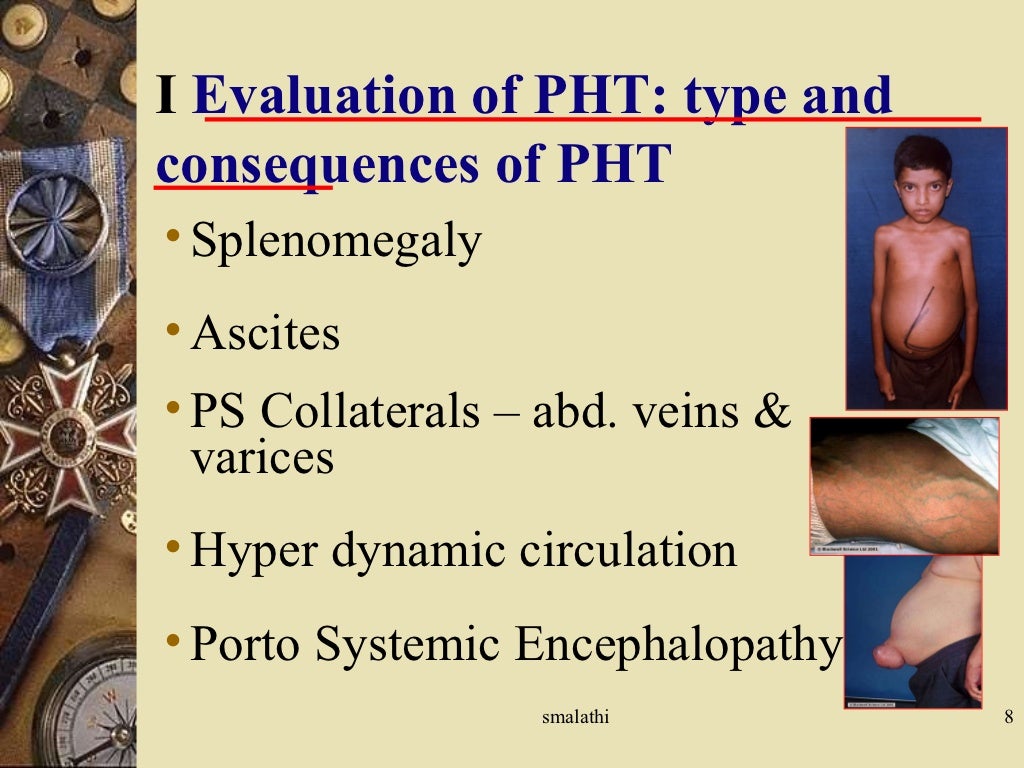 Portal Hypertension in Children.. Dr.Malathi Sathiyasekaran