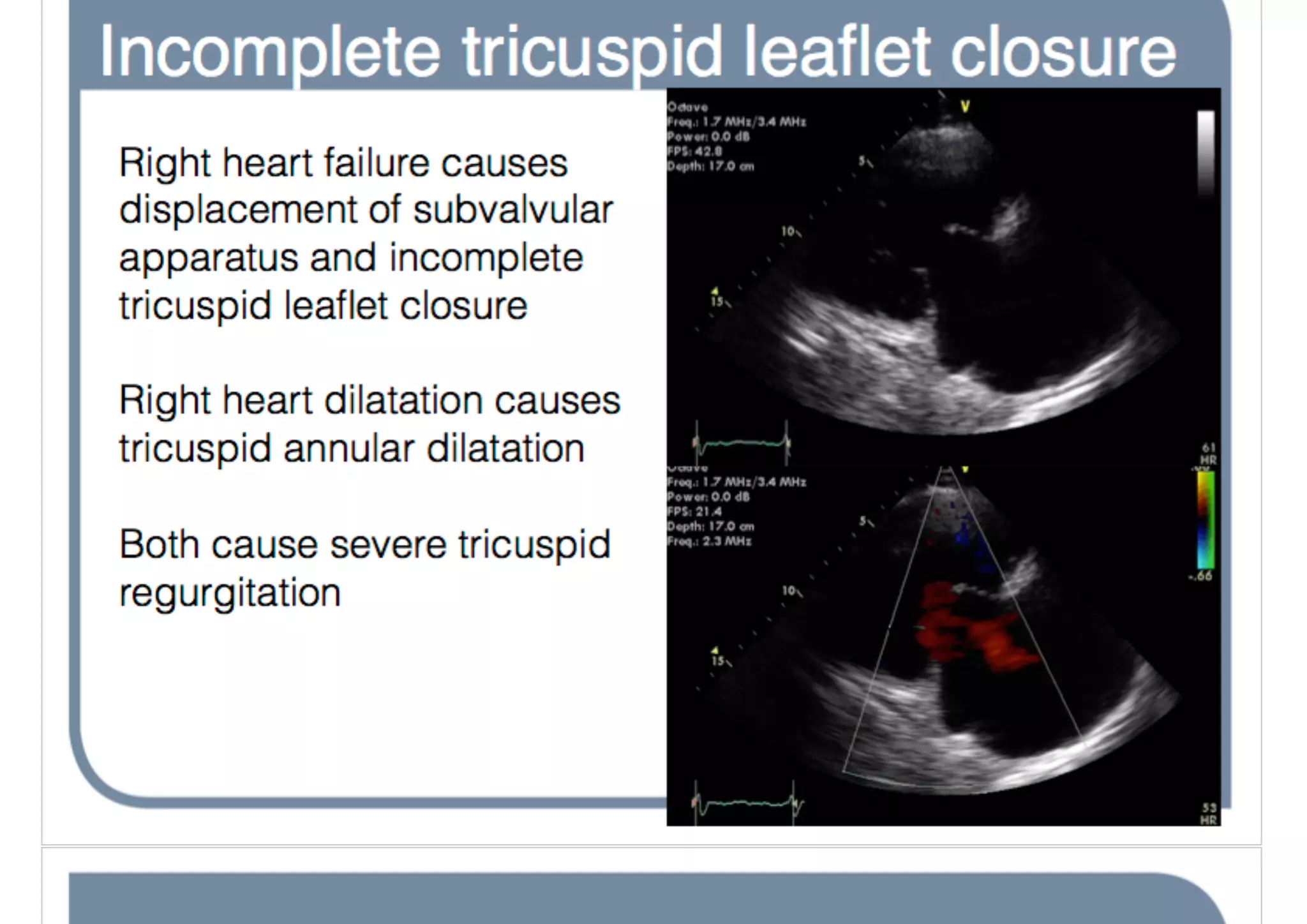 Pht good, bad and ugly.key