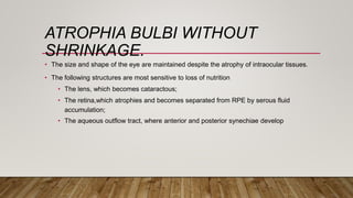 Phthisis bulbi..elias t | PPTX