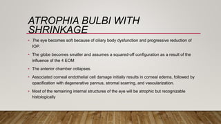 Phthisis bulbi..elias t | PPTX