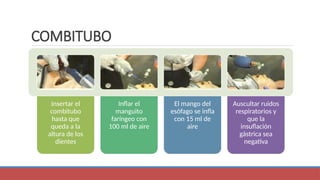 Manejo de vía aérea en atención prehospitalaria | PPTX