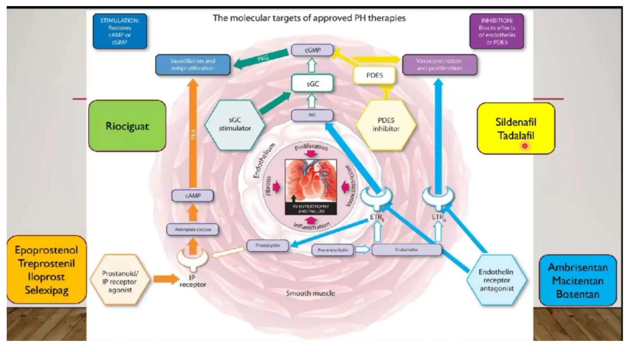 PHTN PULMONARY HYPERTENSION _080028.pptx