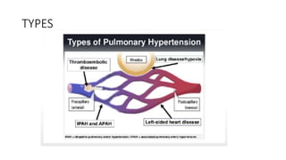 PHTN PULMONARY HYPERTENSION _080028.pptx