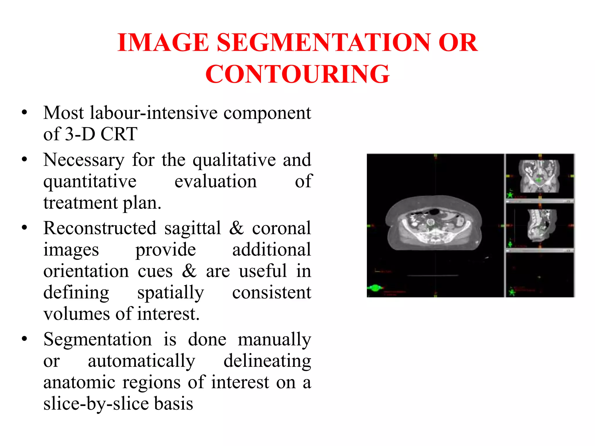 Three dimensional conformal radiotherapy - 3D-CRT and IMRT - Intensity ...