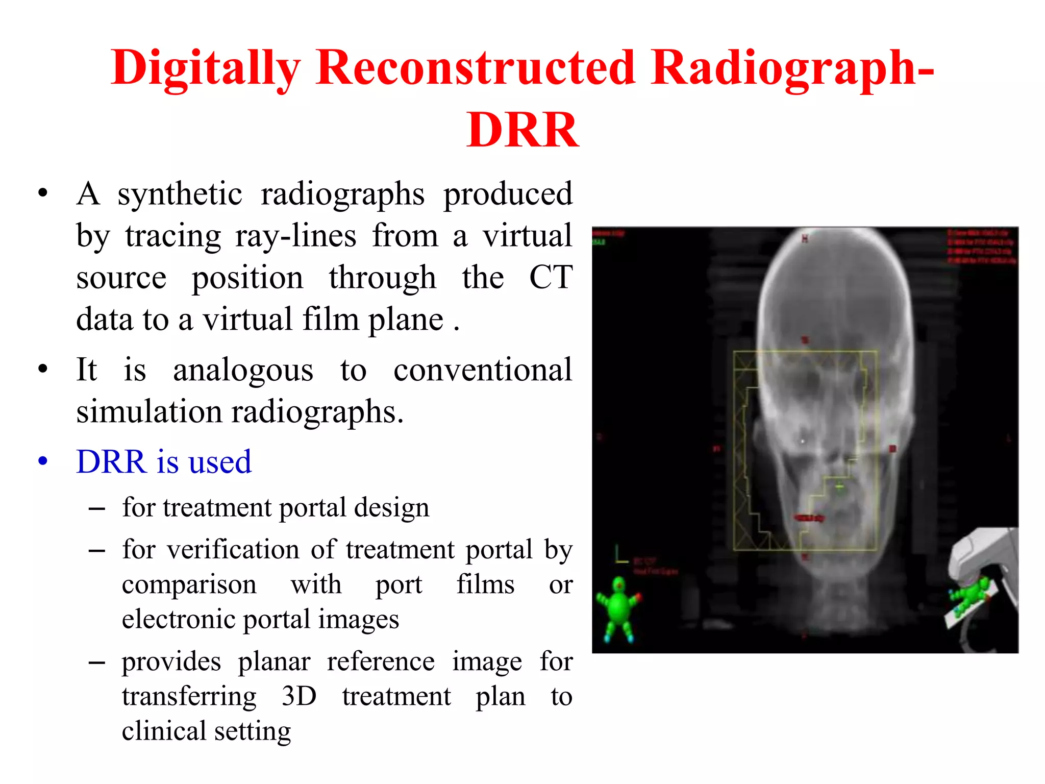 Three dimensional conformal radiotherapy - 3D-CRT and IMRT - Intensity ...