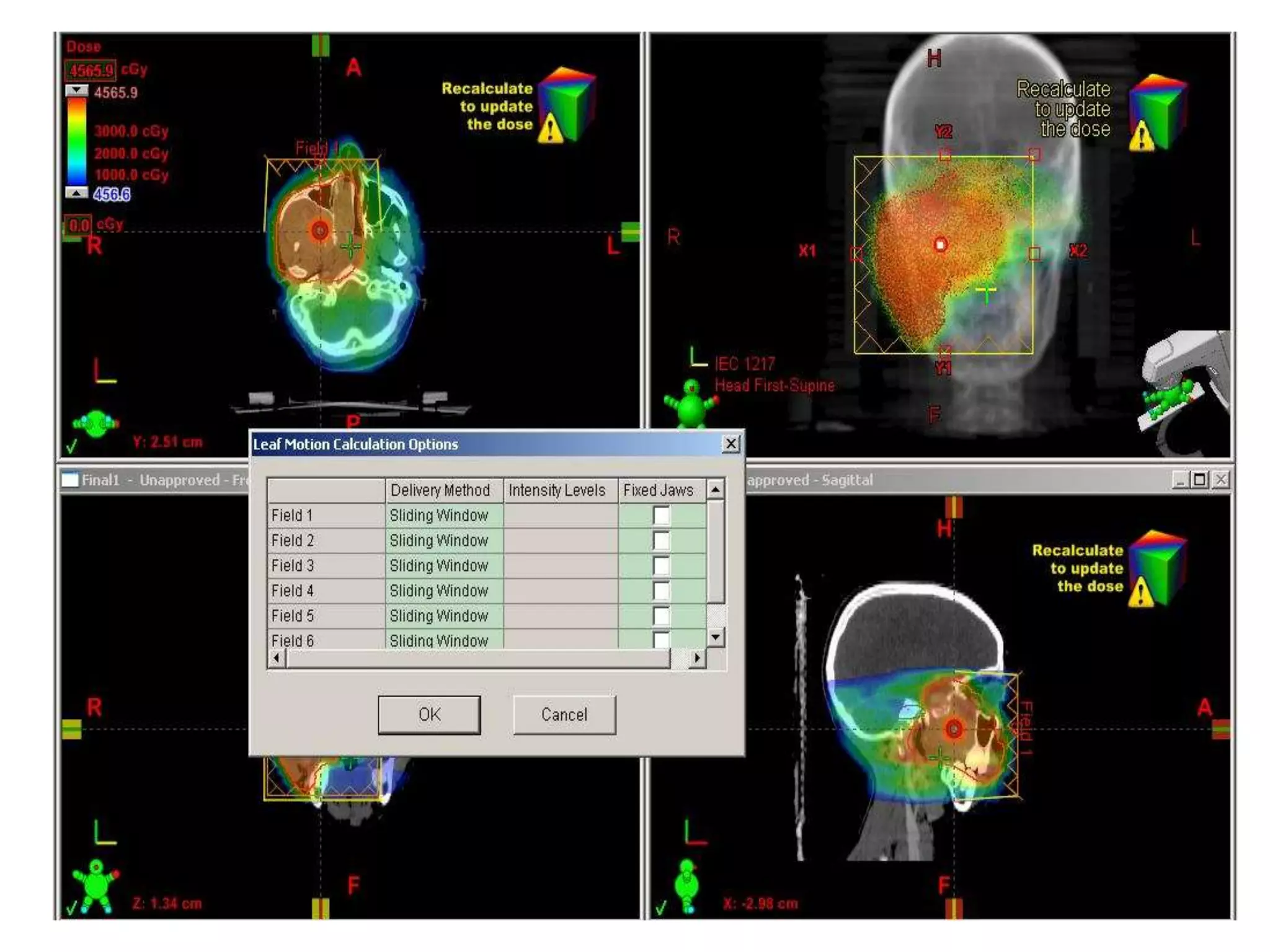 Three Dimensional Conformal Radiotherapy 3d Crt And Imrt Intensity Modulated Radiotherapy
