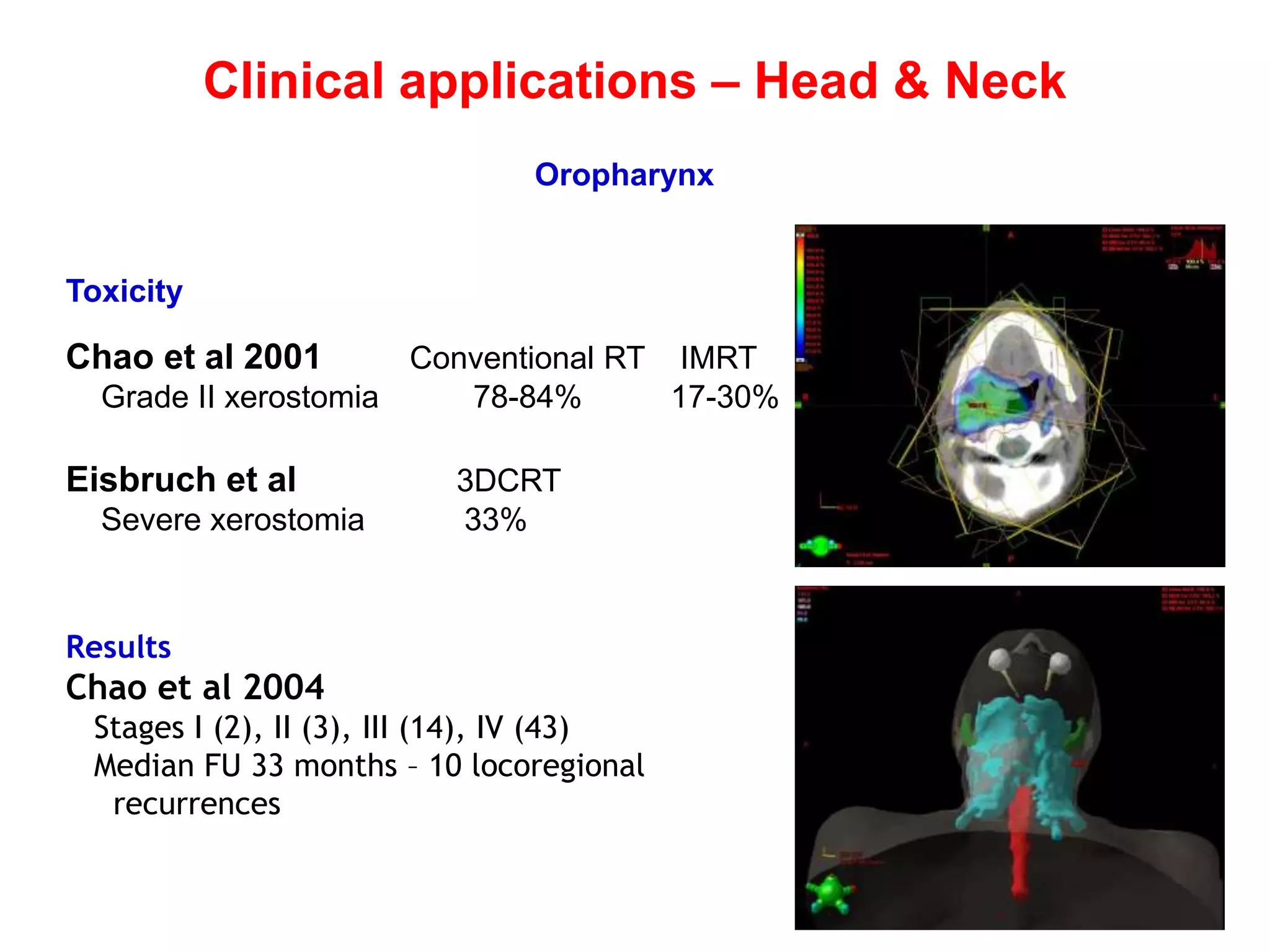 Three dimensional conformal radiotherapy - 3D-CRT and IMRT - Intensity ...