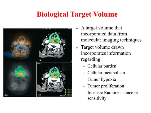 Three dimensional conformal radiotherapy - 3D-CRT and IMRT - Intensity ...