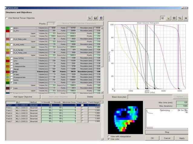 Three dimensional conformal radiotherapy - 3D-CRT and IMRT - Intensity ...