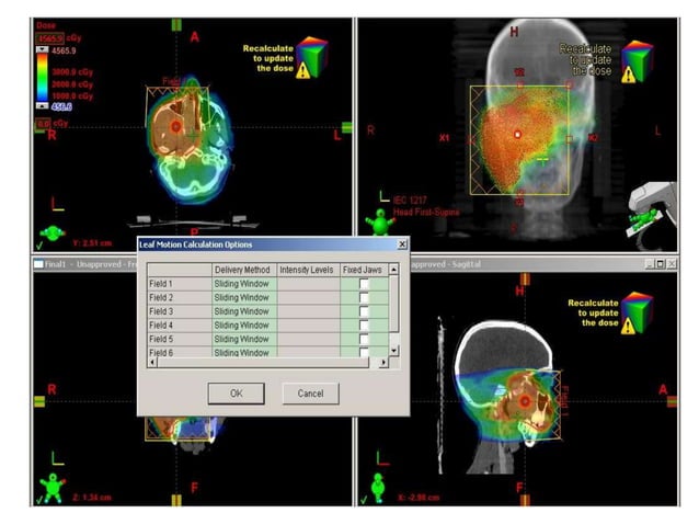Three dimensional conformal radiotherapy - 3D-CRT and IMRT - Intensity ...