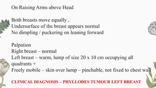 A case of Phyllodes tumor and it's management | PPT