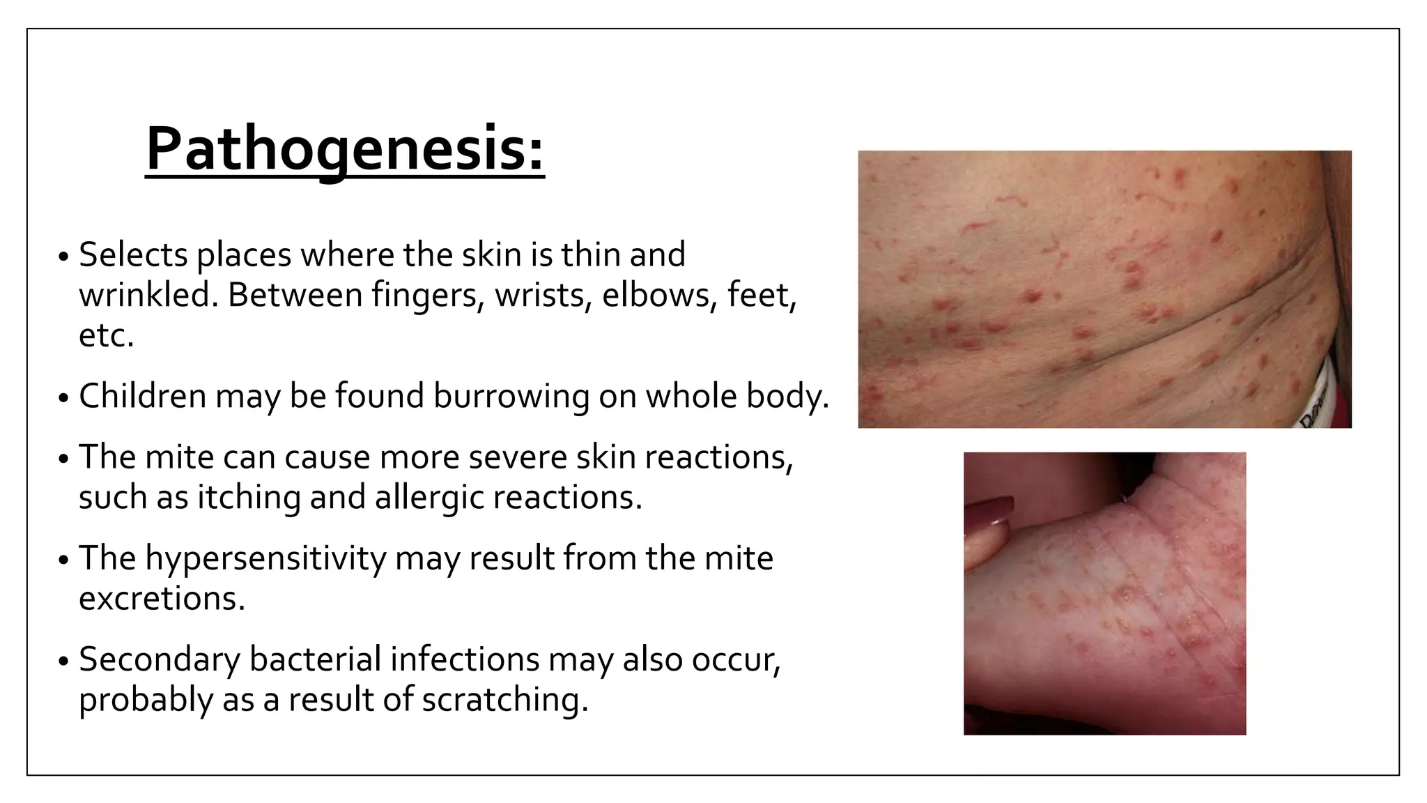 Phylum arthropoda(arthropod characteristics) | PPTX