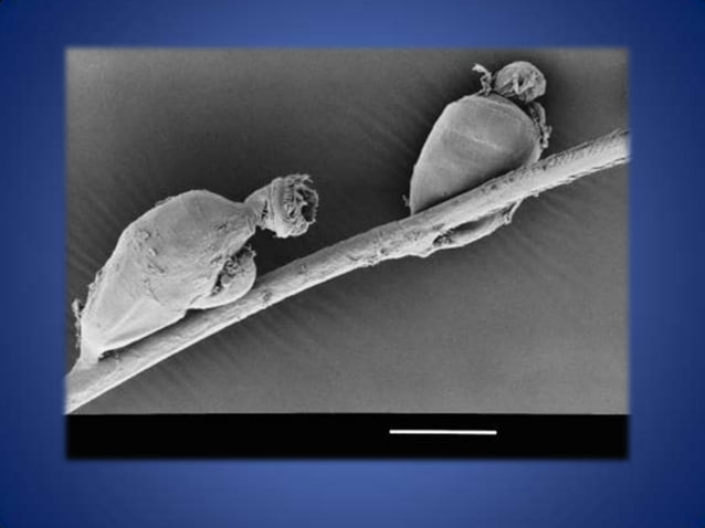 Phylum Cycliophora | PPTX | Infertility | Reproductive Health