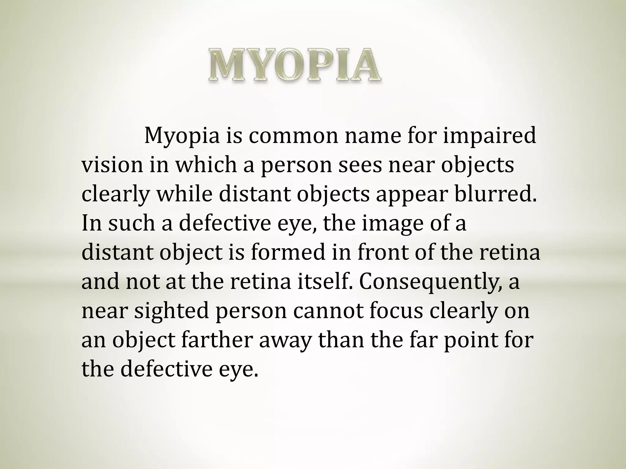 defects of eye class 10 phy | PPTX