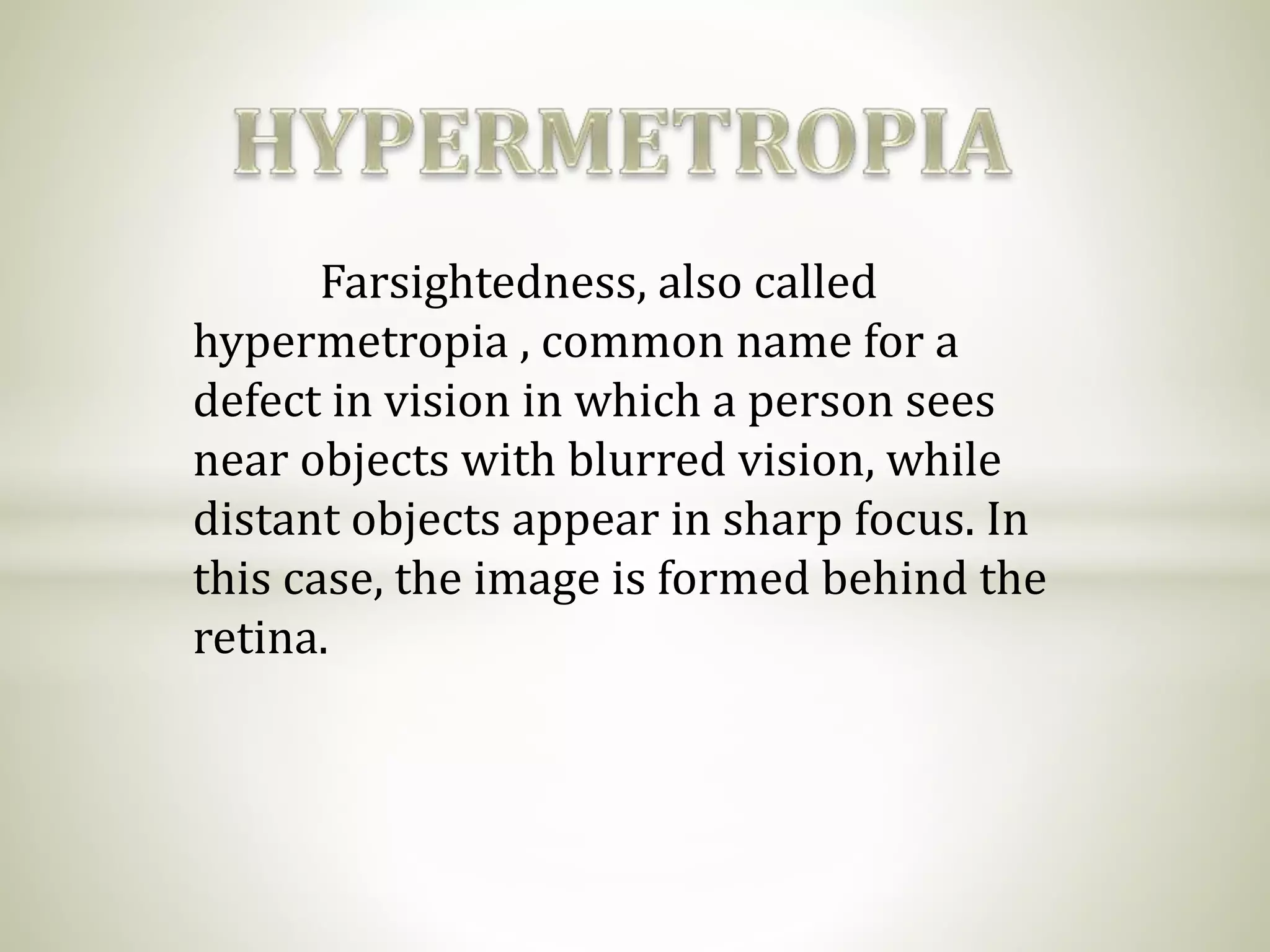 defects of eye class 10 phy | PPTX