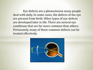 defects of eye class 10 phy | PPTX