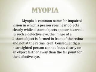 defects of eye class 10 phy | PPTX