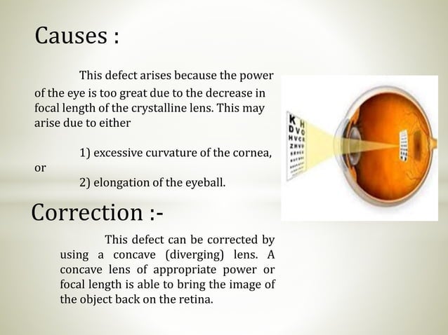 defects of eye class 10 phy | PPTX