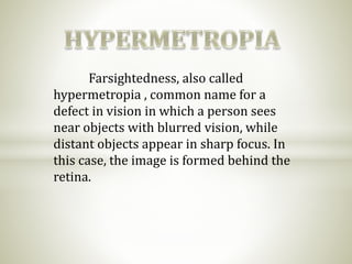 defects of eye class 10 phy | PPTX
