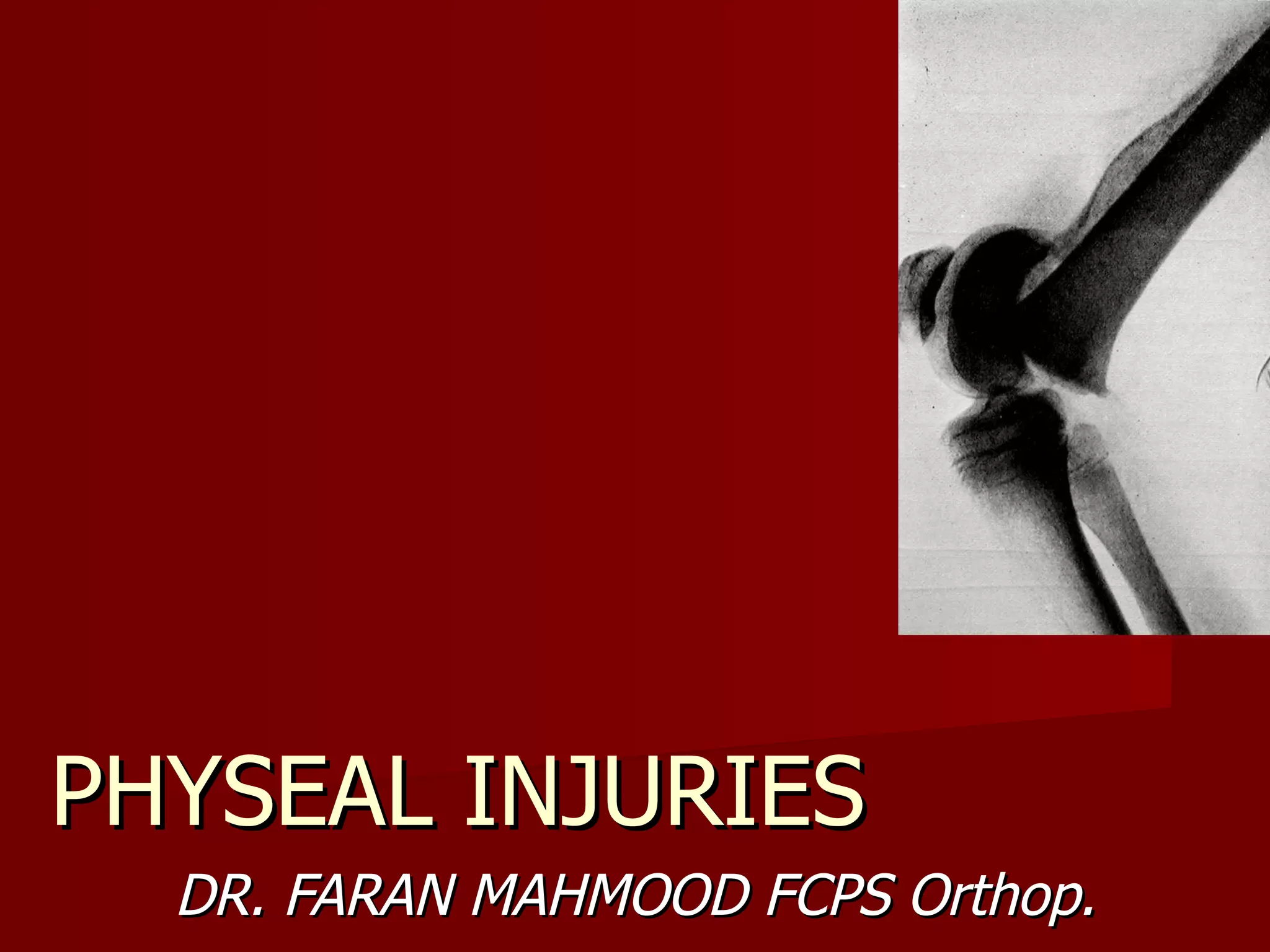 Physeal injuries DR. FARAN MAHMOOD | PPT