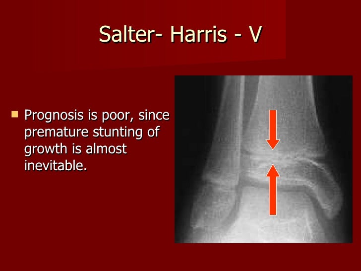 Physeal injuries DR. FARAN MAHMOOD