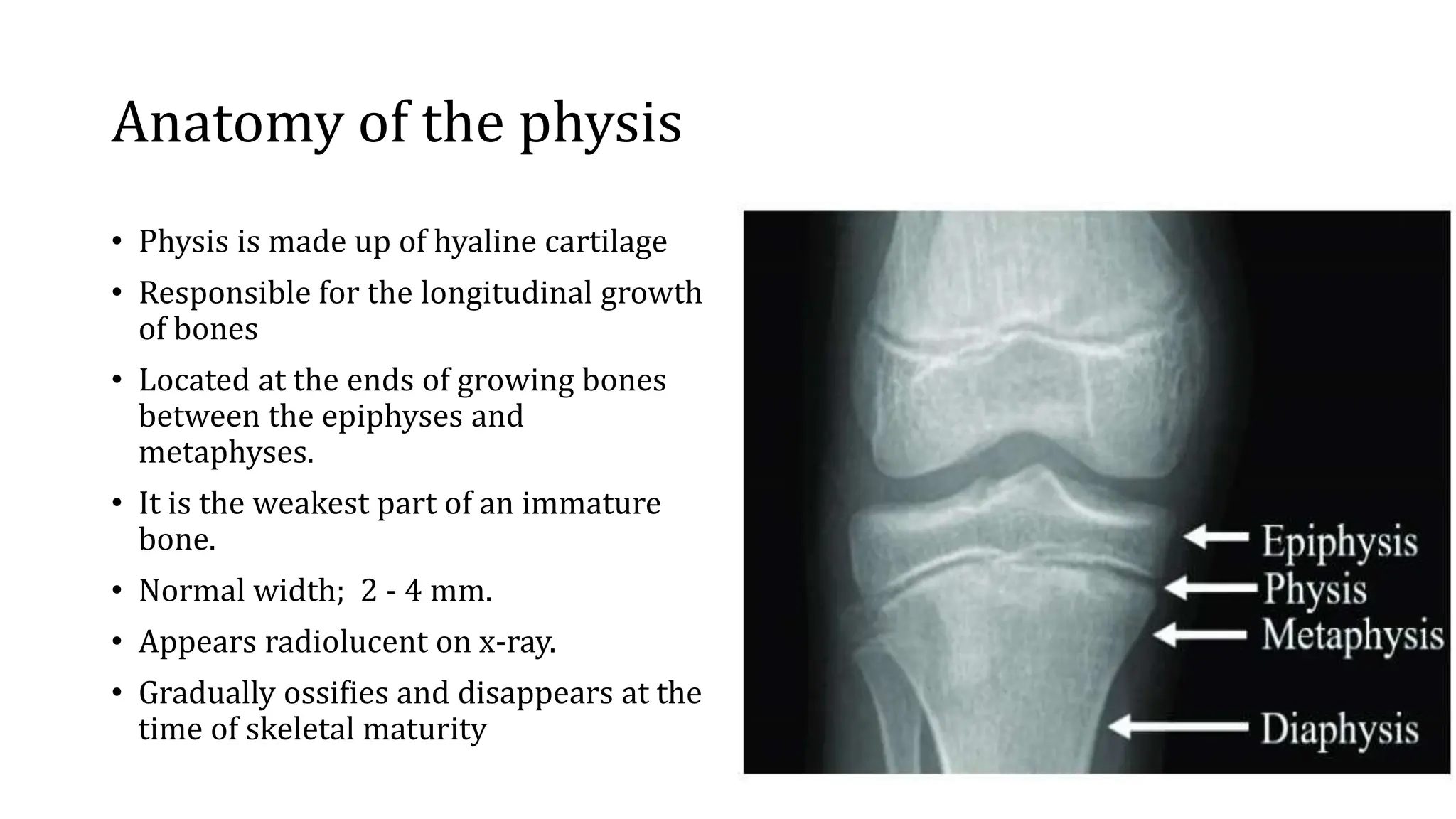 physeal injuries.pptx