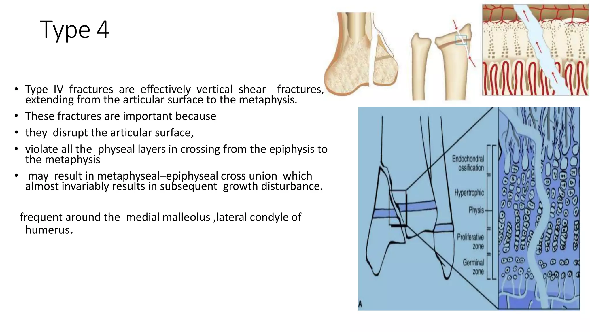 Physial Injuries.pptx