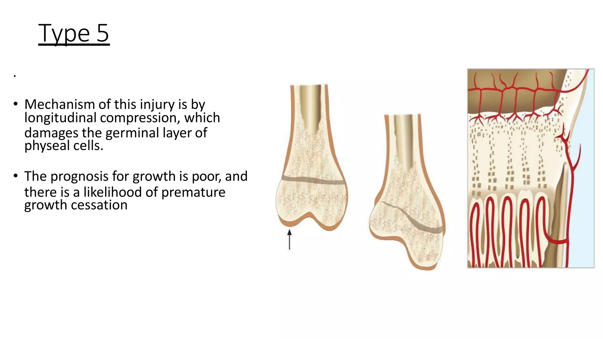 Physial Injuries.pptx