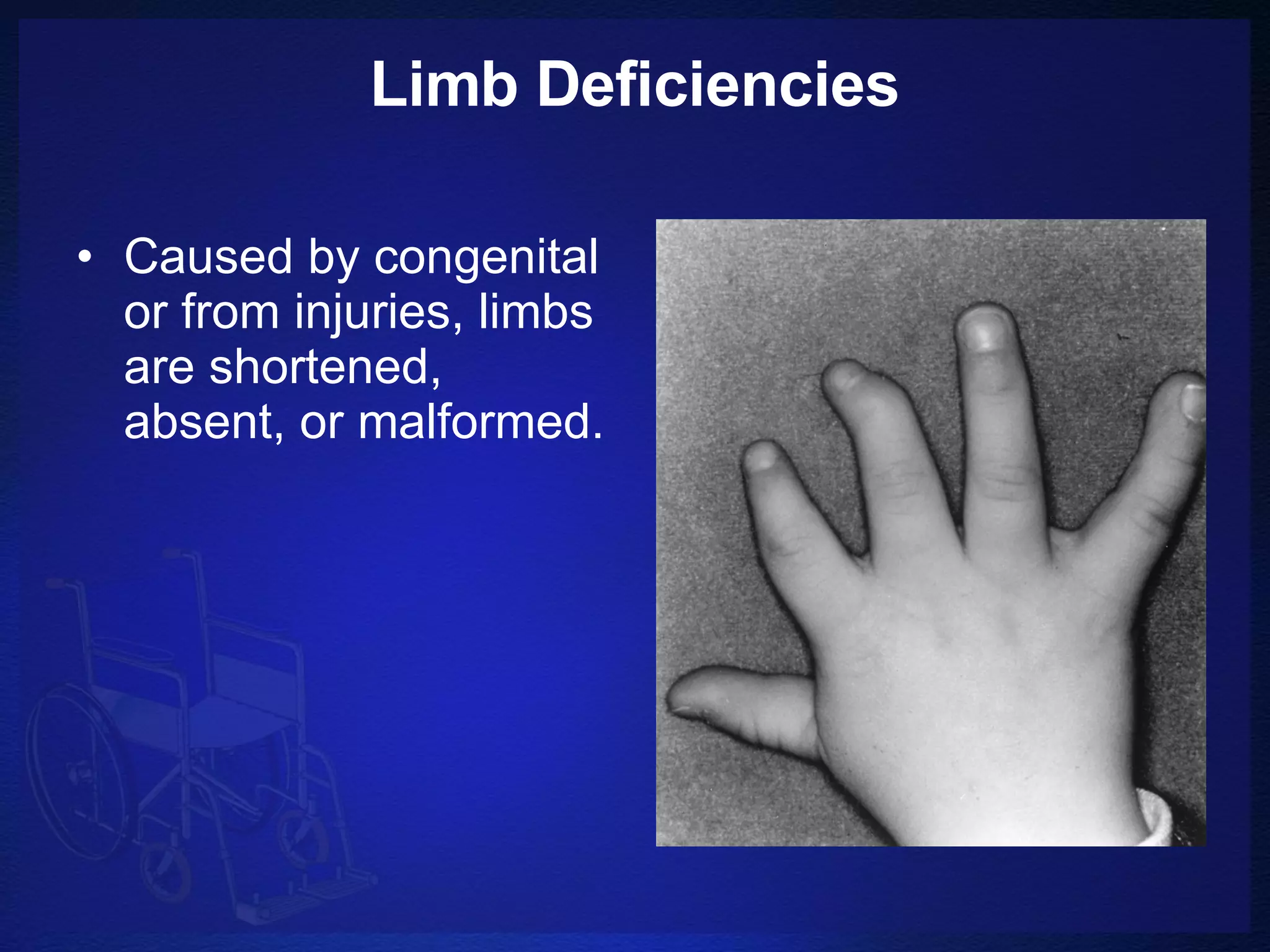 Physical Impairments 97 2003 | PPT