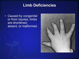 Physical Impairments 97 2003 | PPT | Death, Injury, or Military ...