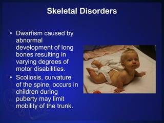 Physical Impairments 97 2003 | PPT