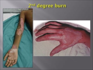 Physical Injuries Section Practical | PPT