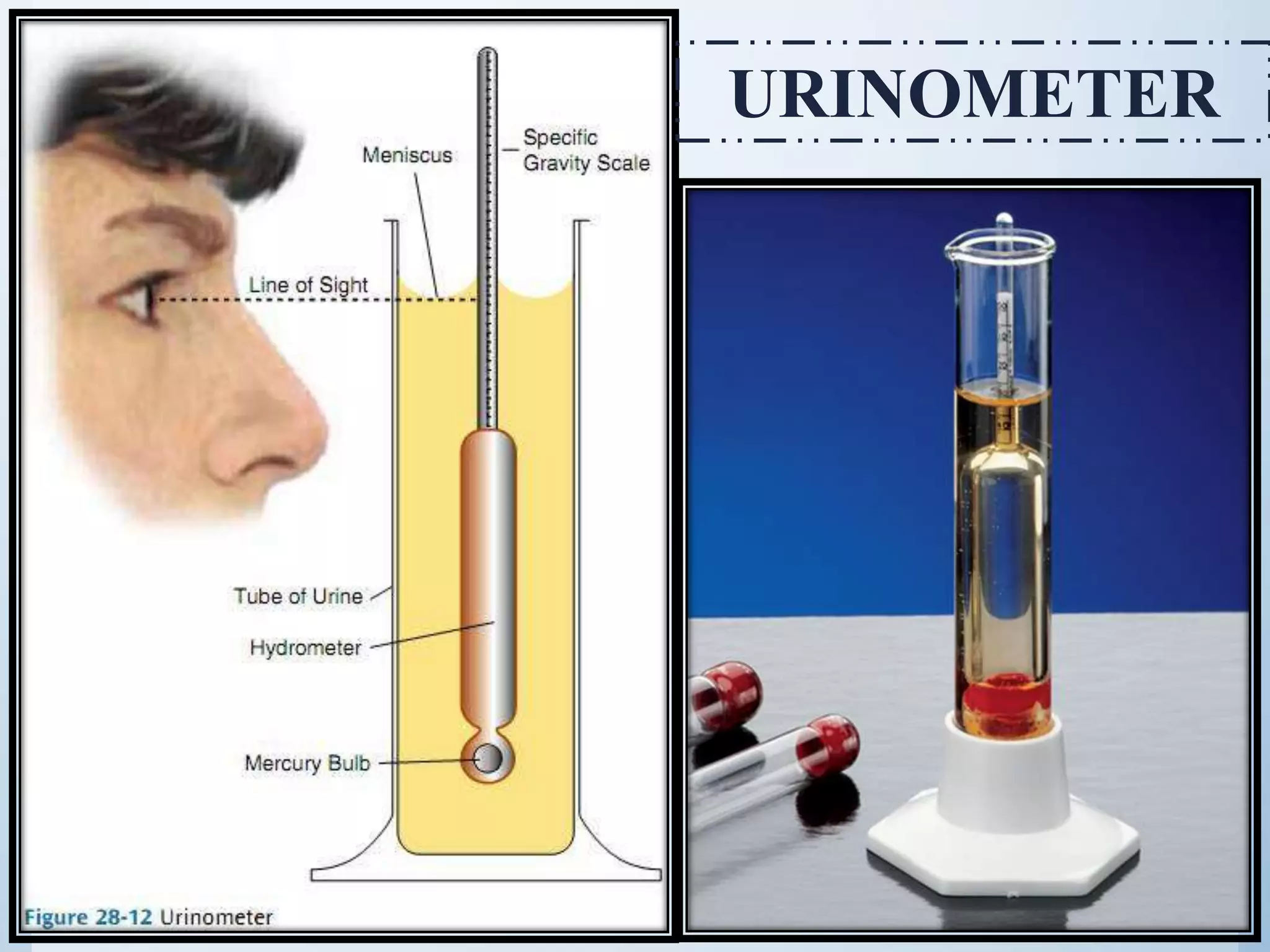 Physical and chemical examination of urine | PPTX