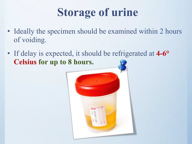 Physical and chemical examination of urine | PPTX | Chemistry | Science