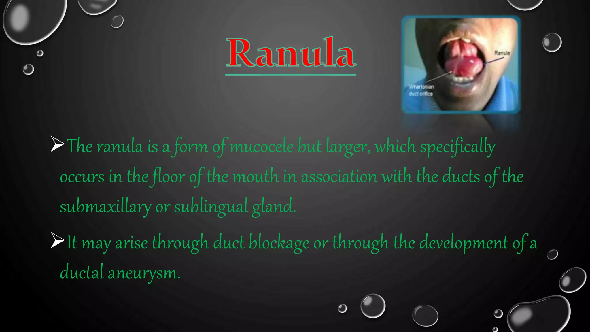 Physical and chemical injuries of oral cavity | PPTX