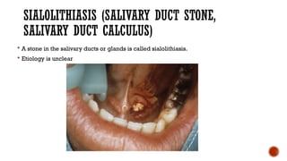 PHYSICAL AND CHEMICAL INJURIES OF THE ORAL CAVITY.pptx
