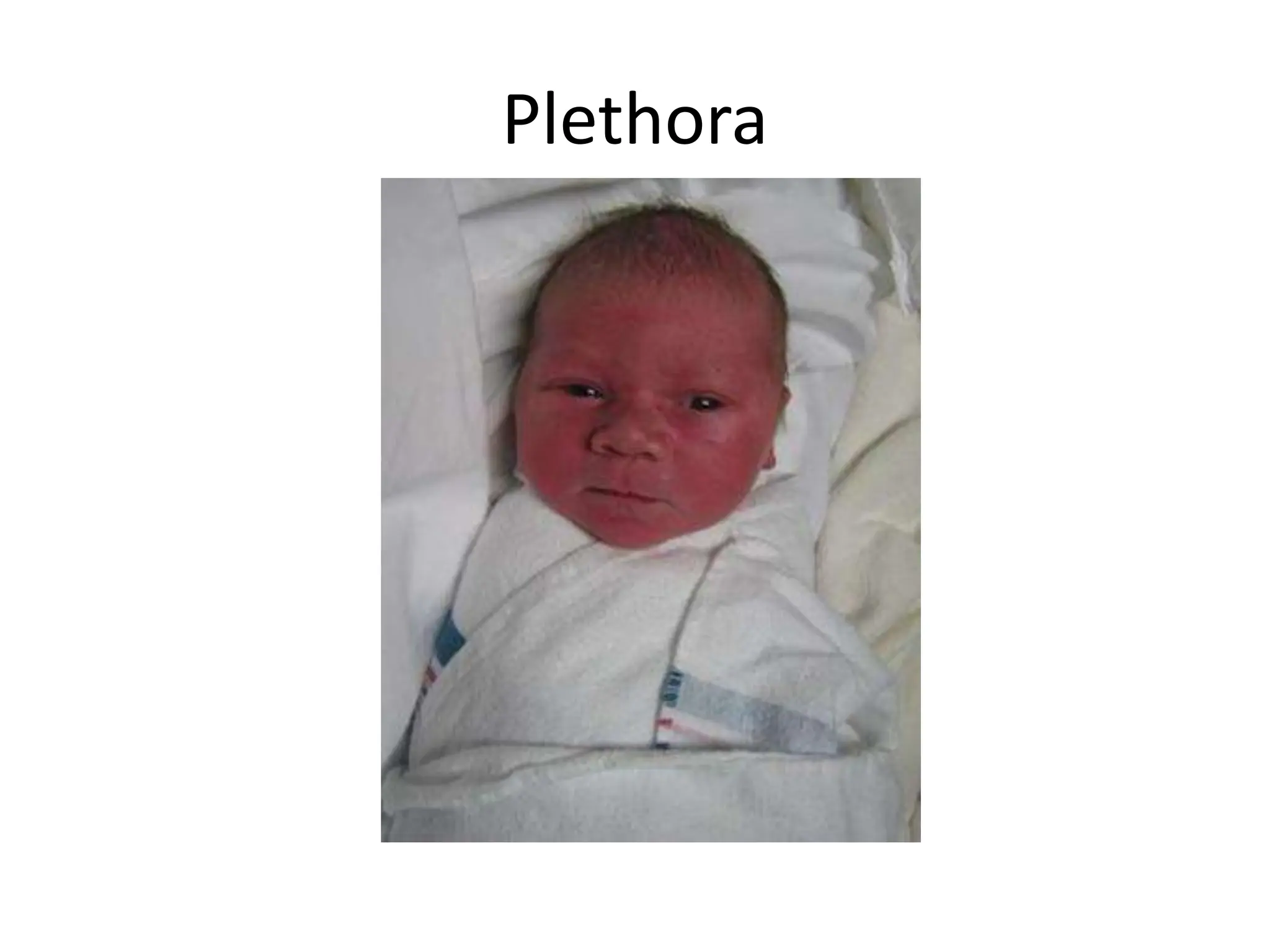 physical ASSESSMENT CHILDREN AND NEONATES.pptx