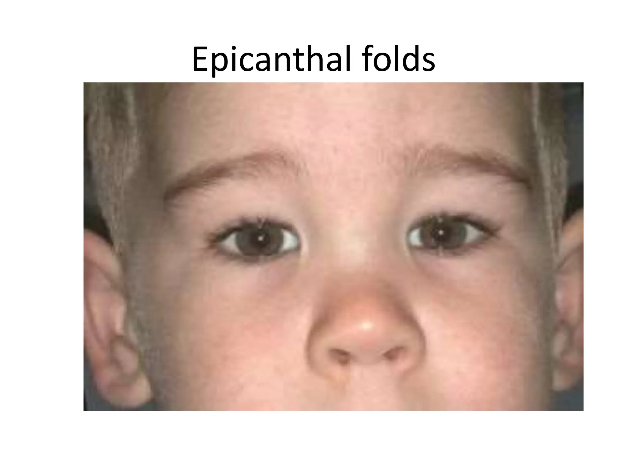 physical ASSESSMENT CHILDREN AND NEONATES.pptx