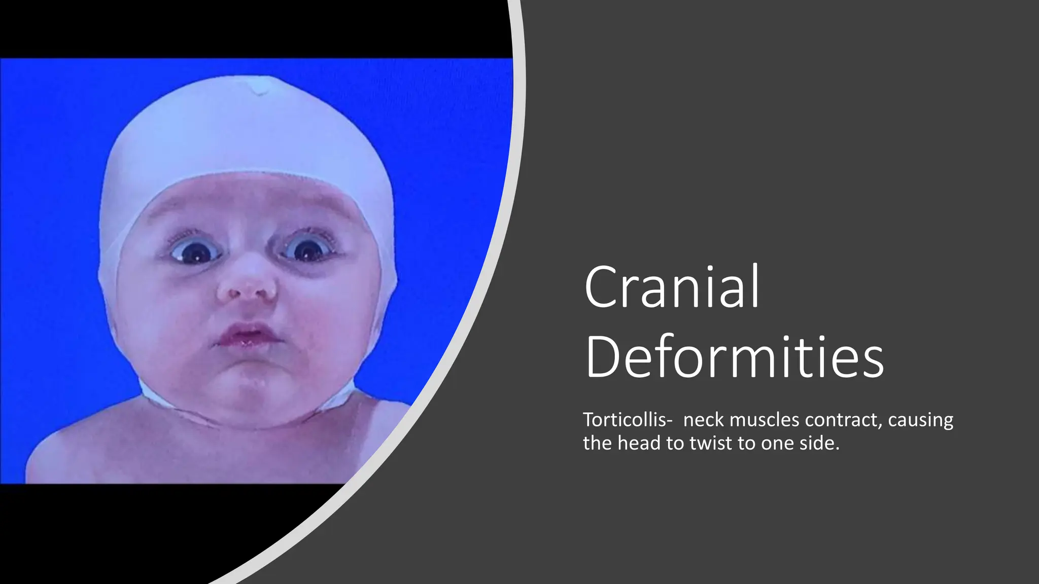 Physical assessment Head and Neck.pptx