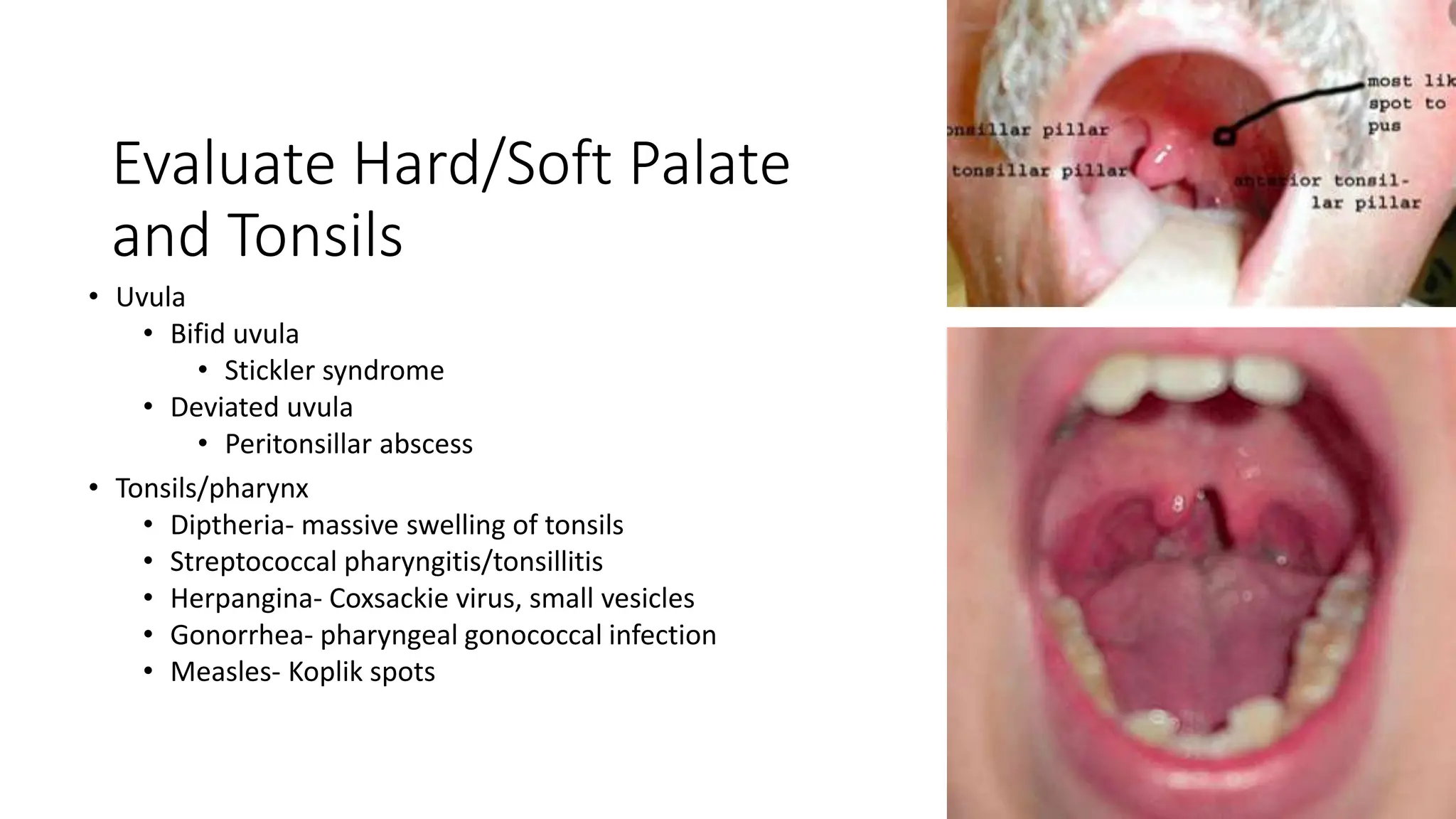 Physical assessment Head and Neck.pptx