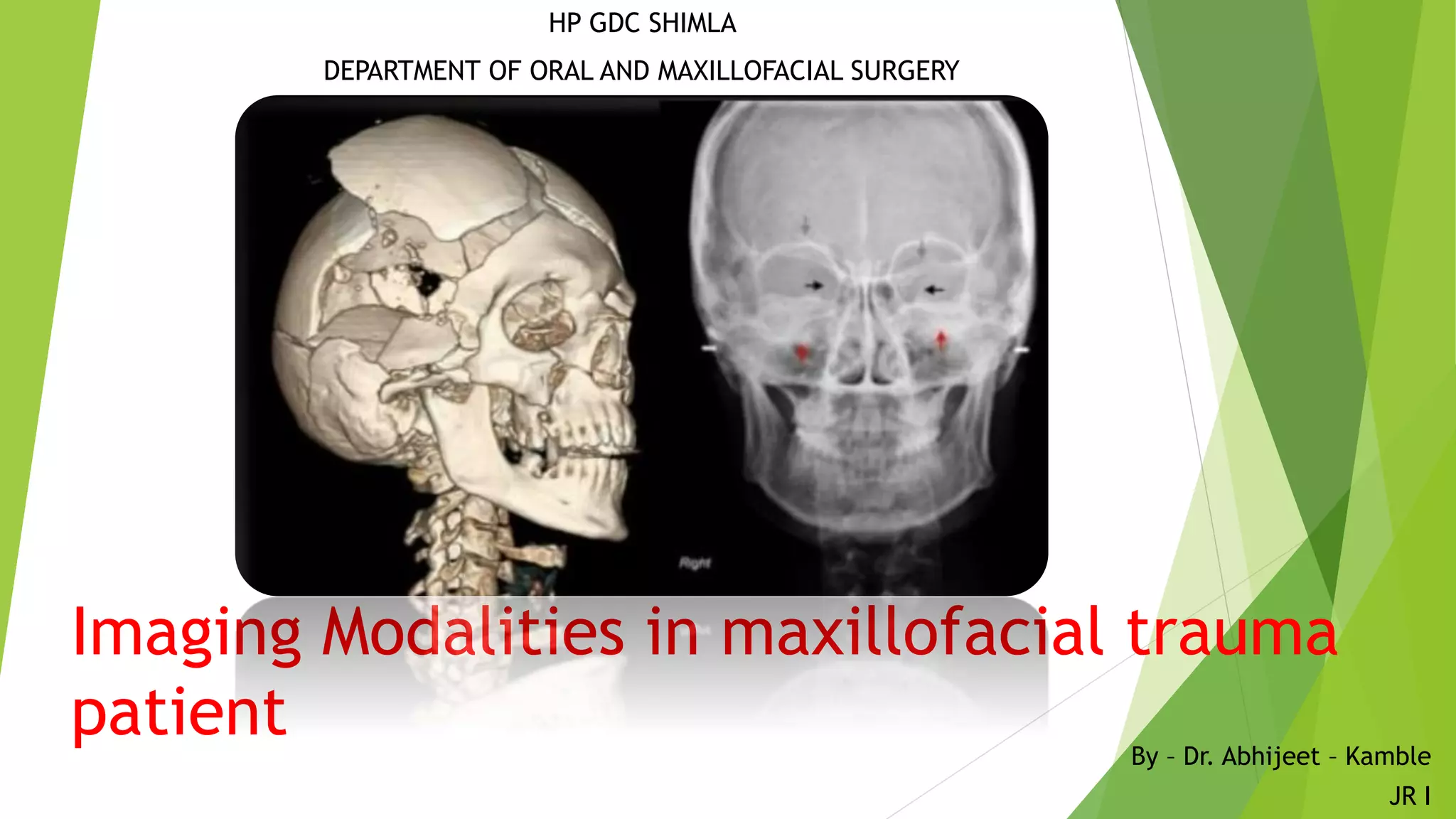 Imagine modalities in Maxillofacial trauma patients.pptx