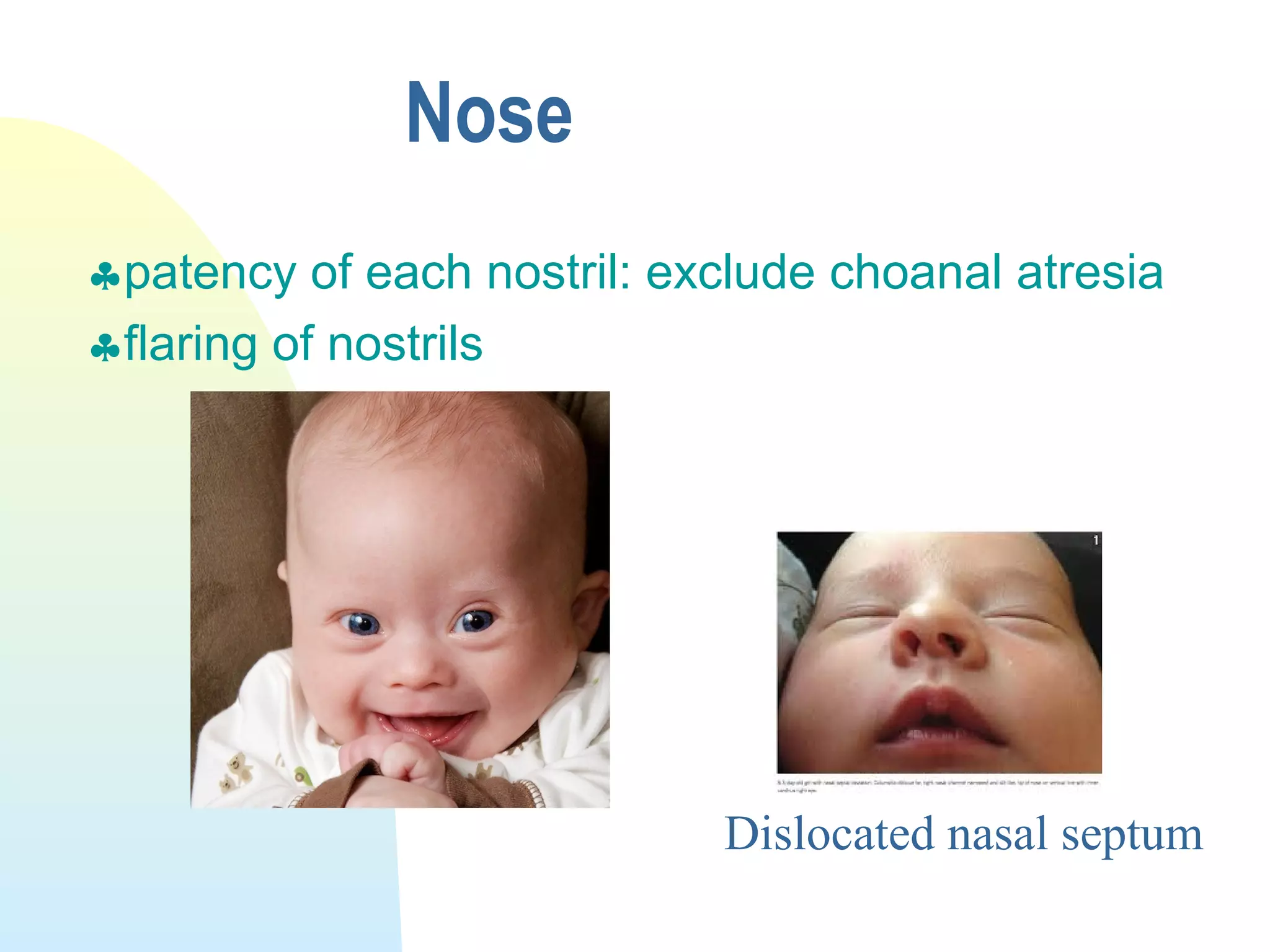 Physical assessment of the neonate | PPT