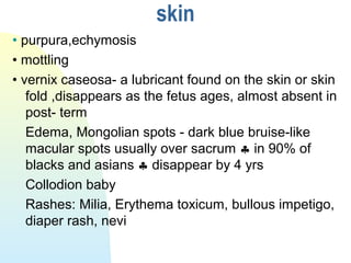 Physical assessment of the neonate | PPT