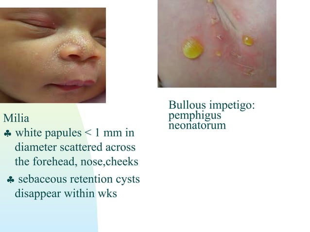 Physical assessment of the neonate | PPT | Pregnancy | Reproductive Health