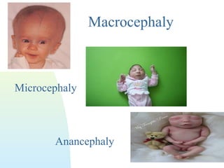 Physical assessment of the neonate | PPT