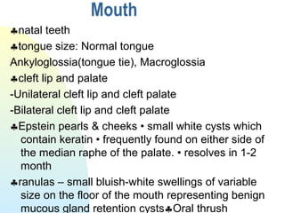 Physical assessment of the neonate | PPT
